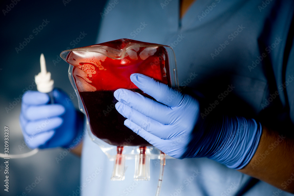 Nurse Prepares Donor IV Blood Unit For Transfusion Stock Photo | Adobe ...