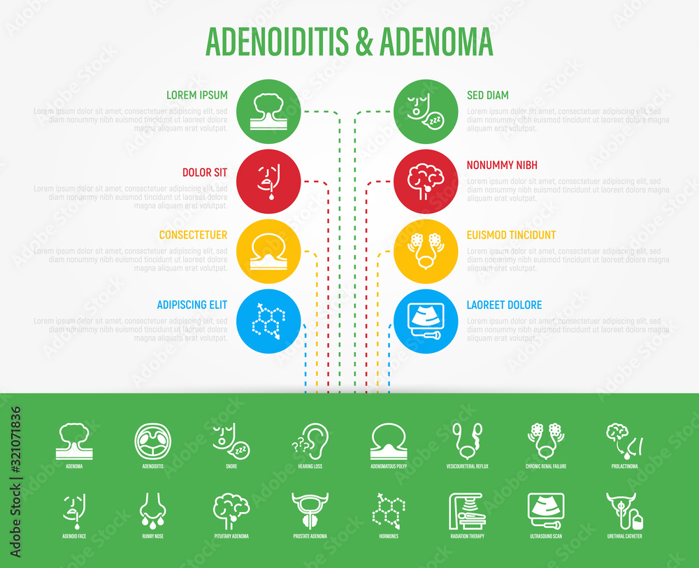 Adenoiditis and adenoma infographics with thin line icons. Benign tumor ...