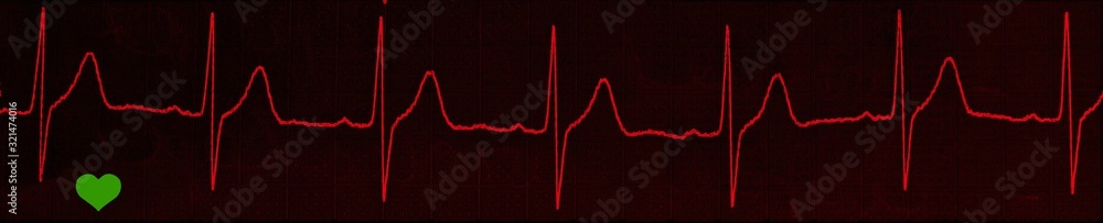 an EKG electrocardiogram with heart pulse Stock Photo | Adobe Stock