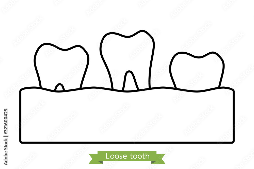loose tooth, tooth is fall out of the gum - dental cartoon vector ...