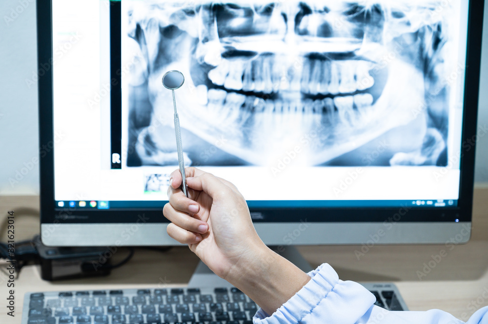 Fotografia do Stock: Close up dentist hand holding mirror tooth and out ...