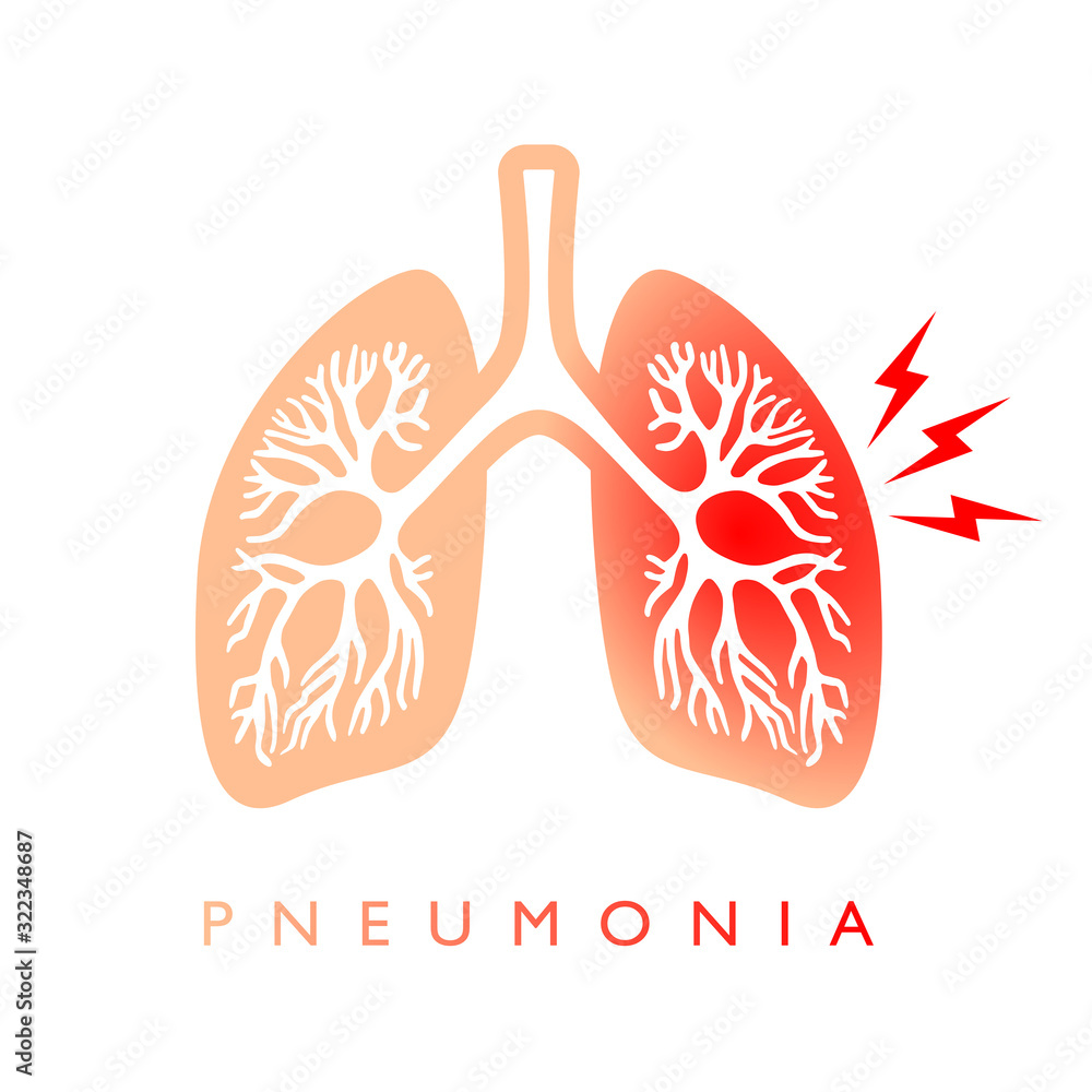 Lungs pneumonia vector icon Stock Vector | Adobe Stock