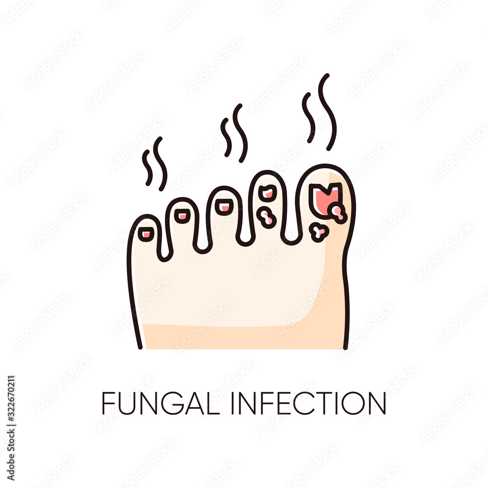 Fungal infection RGB color icon. Dermatological infectious disease ...