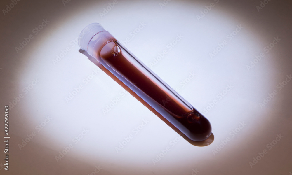 Sample of blood in a tube test. exam test Stock Photo | Adobe Stock