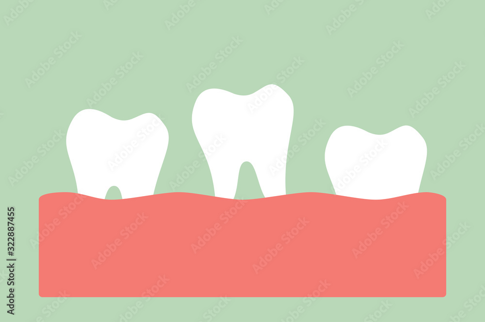 loose tooth, tooth is fall out of the gum - dental cartoon vector flat ...