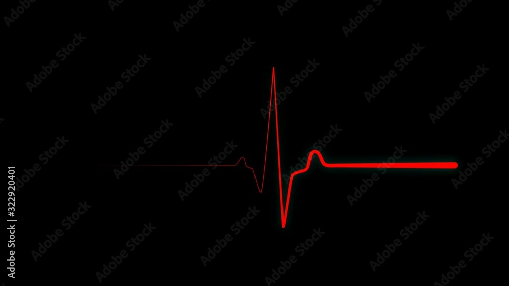 Vidéo Stock Heartbeat flatline on EKG or ECG screen in close-up. Heart ...