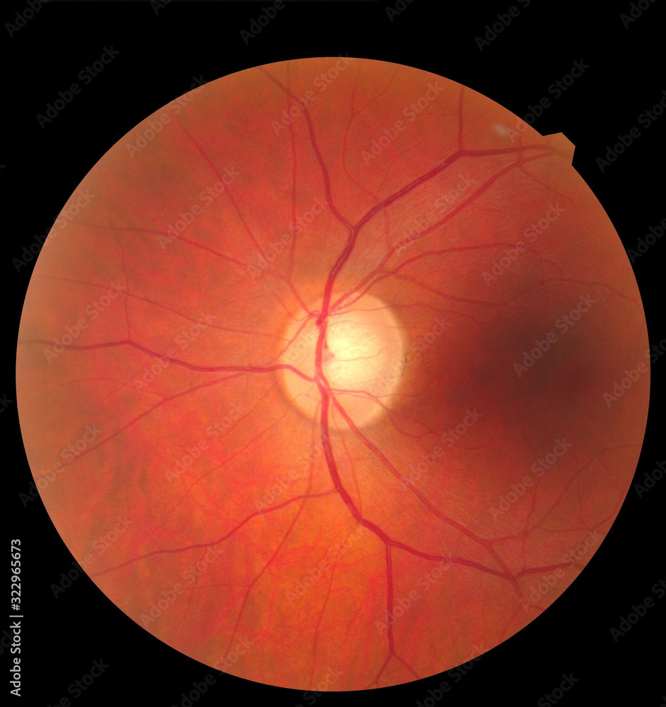 Human eye anatomy taking images with Mydriatic Retinal cameras ...