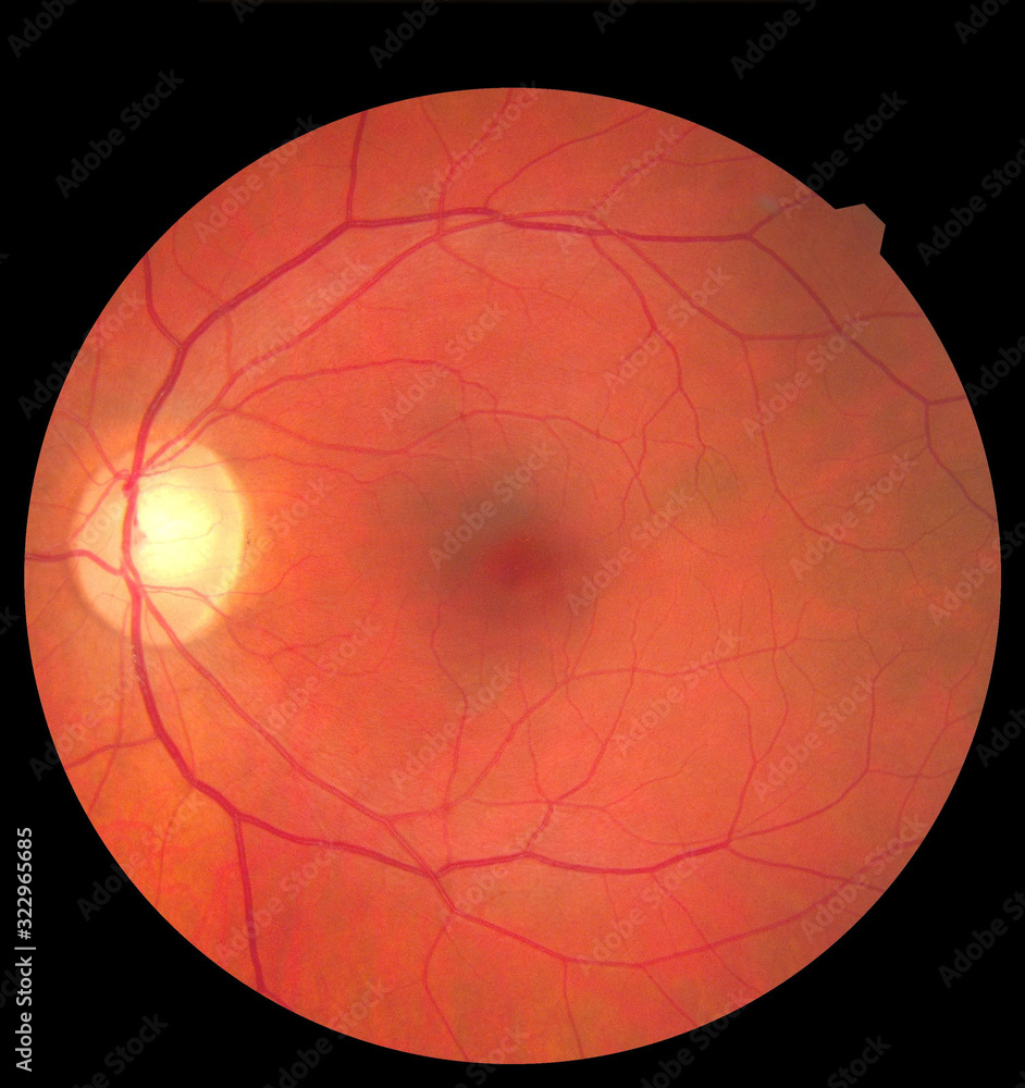 Human eye anatomy taking images with Mydriatic Retinal cameras ...
