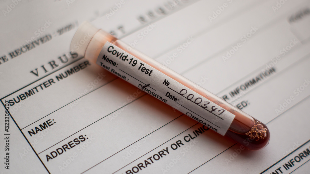 Blood contaminated with virus inside a test tube. Test tube on a ...