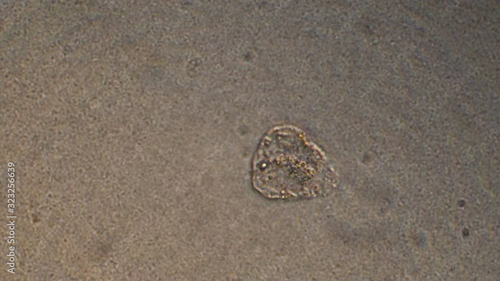 Microscopy of protozoa in the water sample. Magnification 300x ...