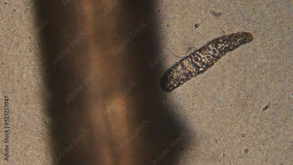 Microscopy of human eyelash with Demodex. Magnification 300x body of ...