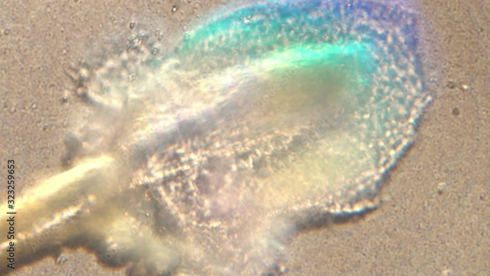 Microscopy of human hair (eyelash and eyebrow). Magnification 150x root ...