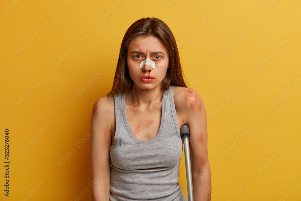Hurt wounded teenager has various bruises, hematoma after inline ...