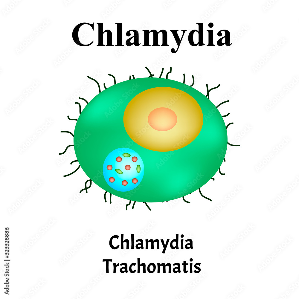 Chlamydia trachomatis. Bacterial infections Chlamydiosis. Sexually ...