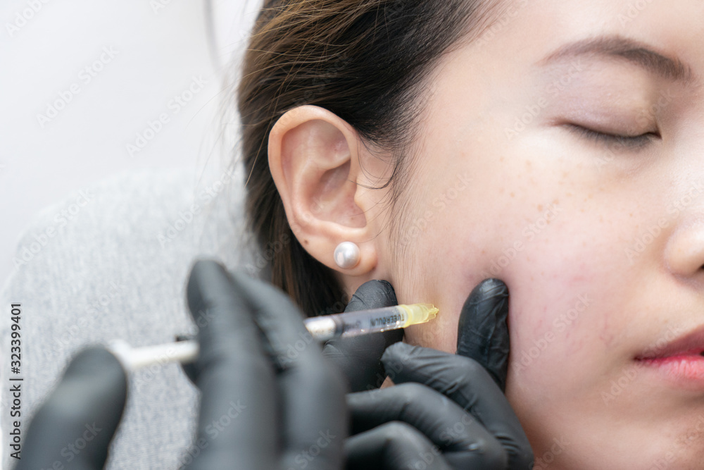 Botox, Filler injection for Asian female face. Plastic aesthetic facial ...