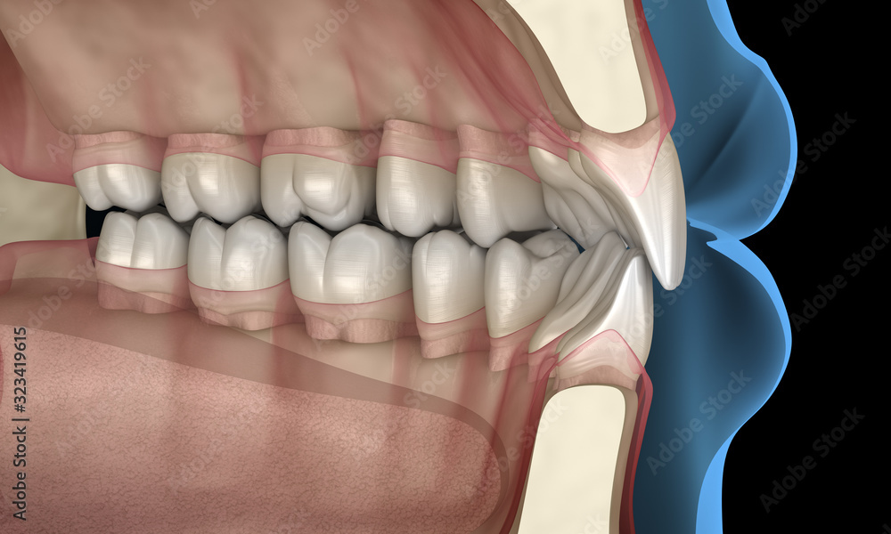 Healthy human teeth with normal occlusion, 3D Illustration Stock ...