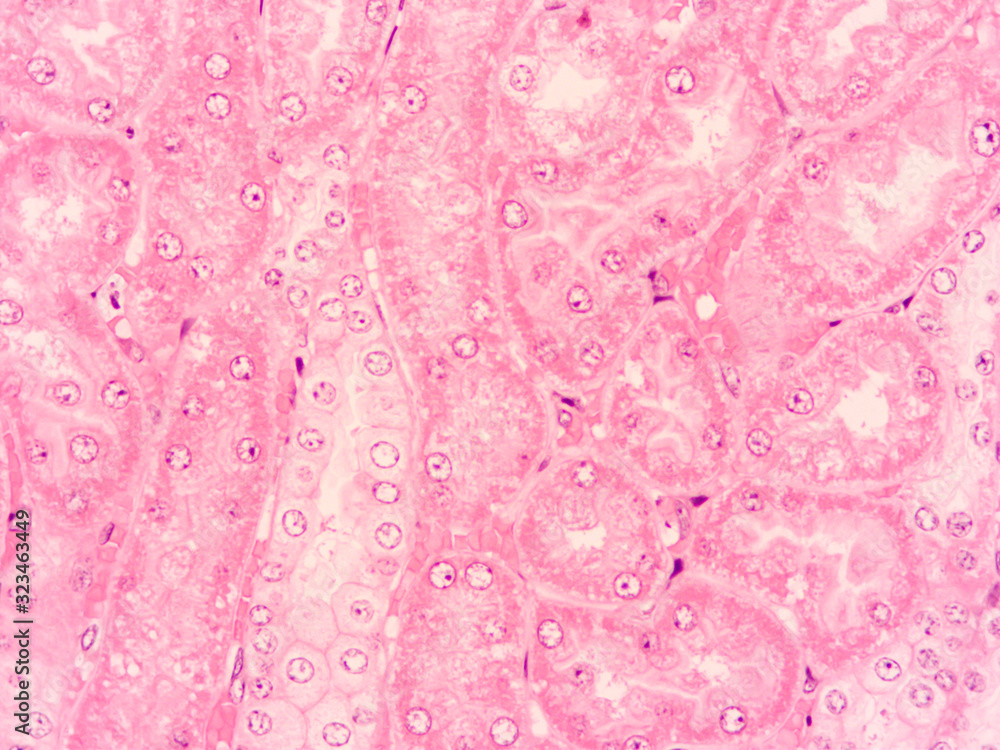 picture of histology human tissue with microscope from laboratory (not ...