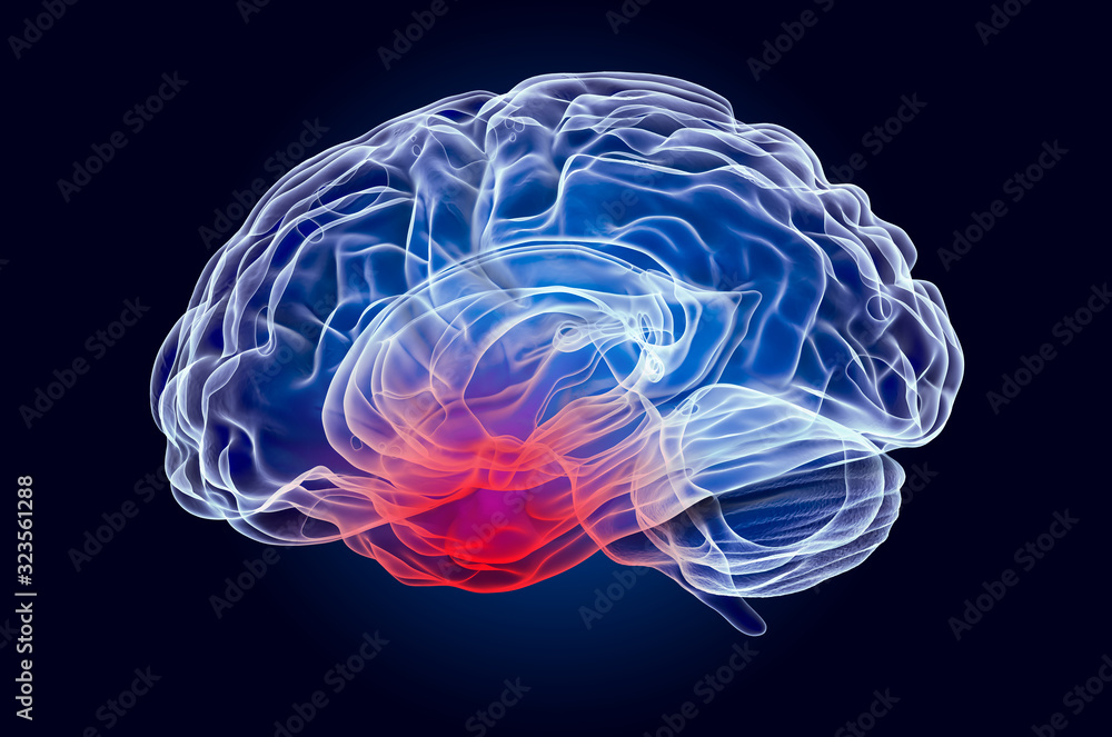Brain, disease of temporal lobes concept. 3D rendering Stock ...