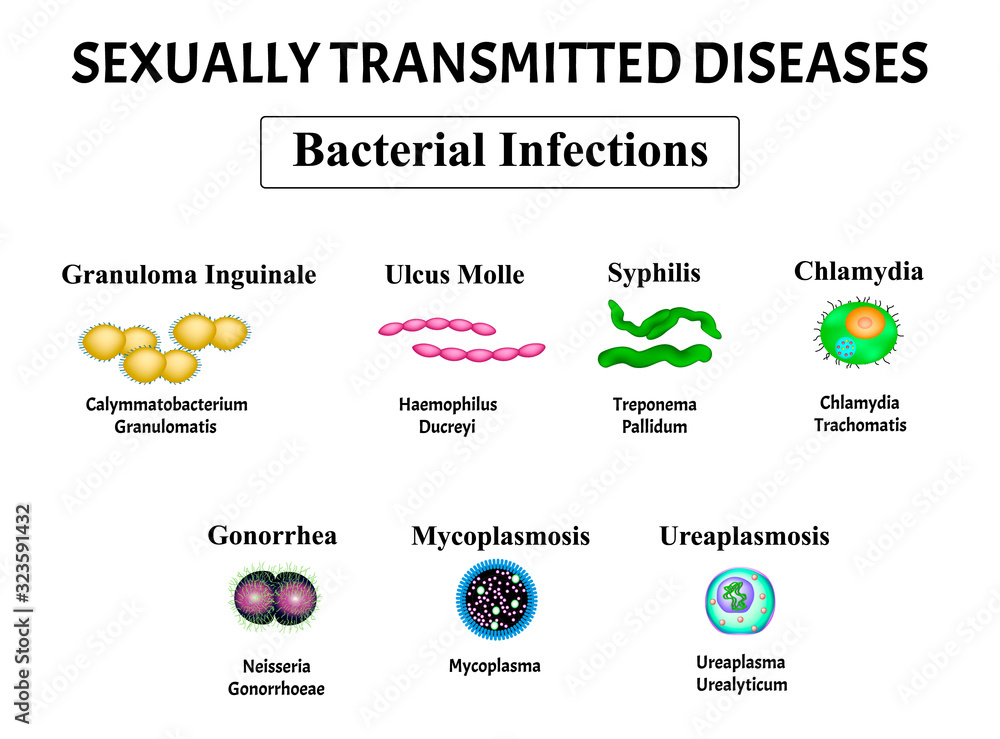Chlamydia Bacterial Infection