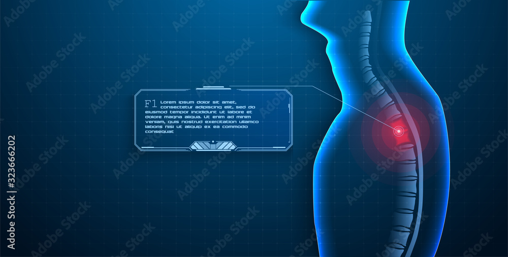 Pain in the spine, a man with backache. Spine pain-x-ray of the ...