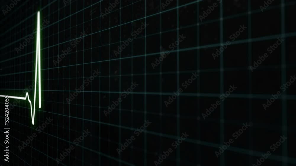Heartbeat flatline. EKG or ECG screen in close up. Heartrate ...