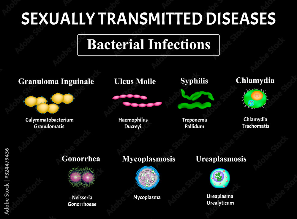 Chlamydia Bacterial Infection