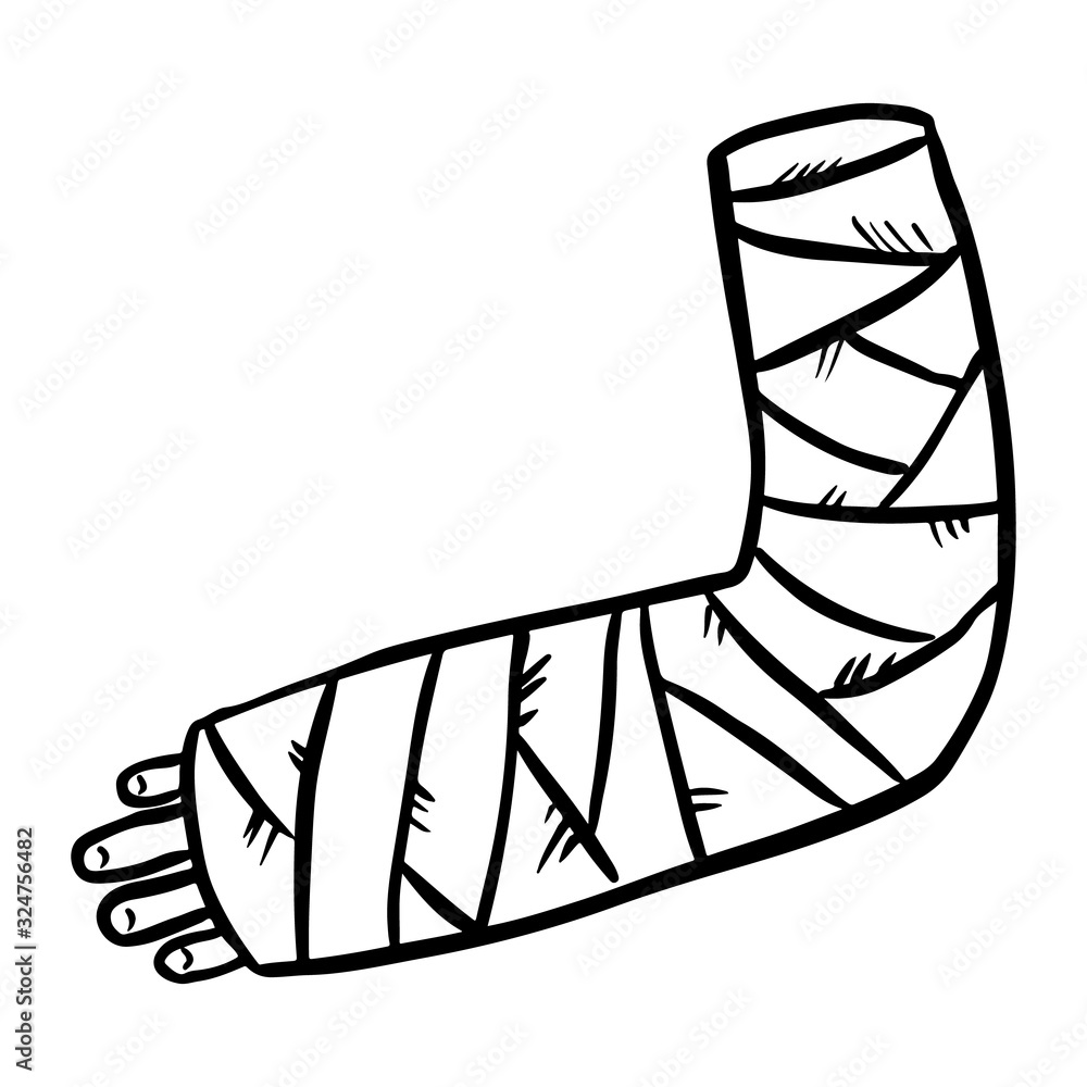 Broken arm cast doodle. Injured limb in gypsum plaster. Media glyph ...