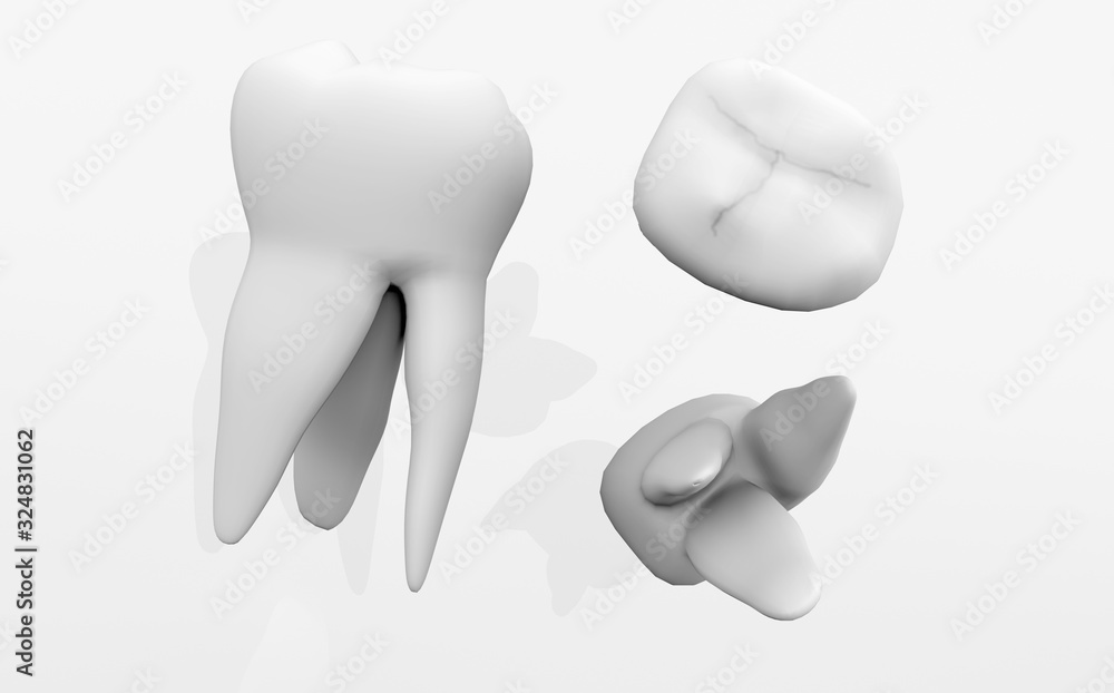 Tooth lateral. Front view, top view, bottom view. Dental implantation ...
