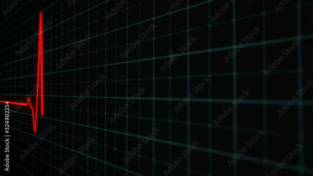 Heartbeat cardiogram, ECG or EKG screen. Monitoring vital signs of the ...