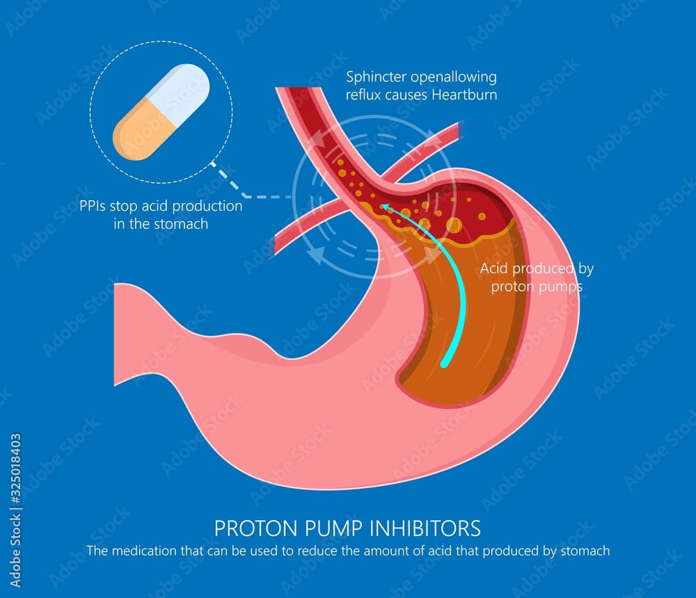 Proton pump inhibitors drugs medication for treatment stomach acid ...