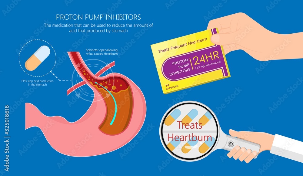Proton pump inhibitors drugs medication for treatment stomach acid ...