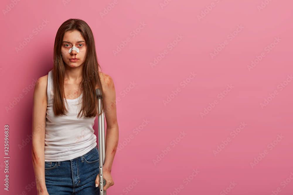 Image of bruised displeased woman injured during traffic accident, has ...