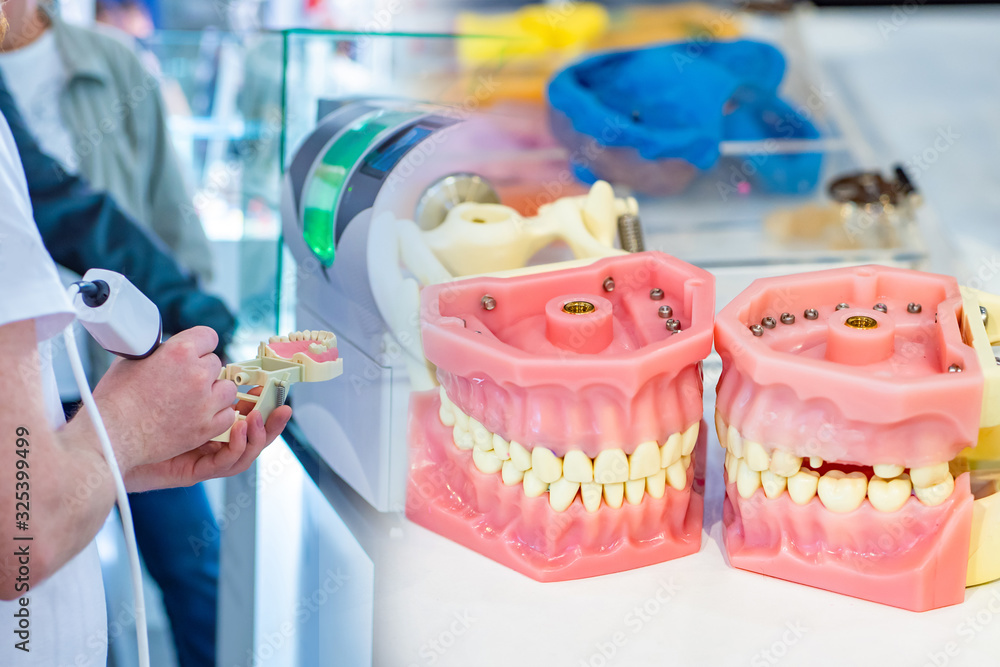 Models of the jaws of people with various disorders. Dentistry. Denture ...