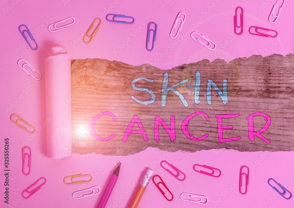 Handwriting text Skin Cancer. Conceptual photo uncontrolled growth of ...