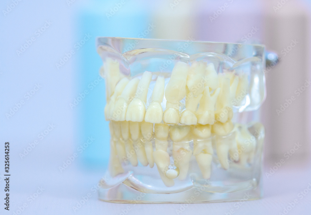 Closeup on dental model on a pastel background. Milk and permanent ...