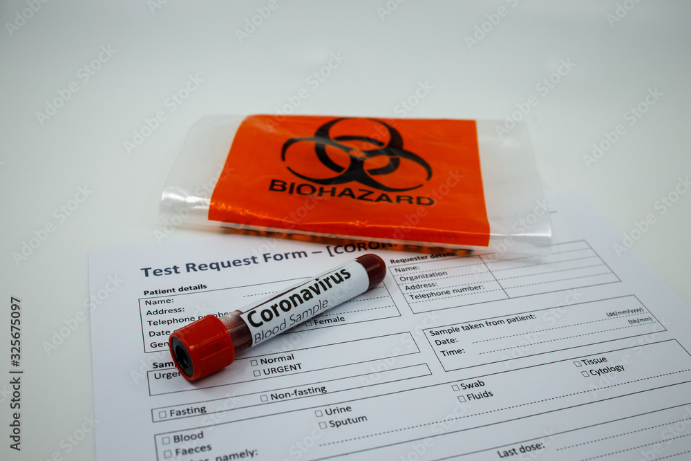 Stockfoto Blood sample for the new rapidly spreading Coronavirus that ...