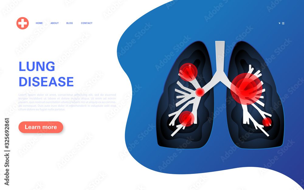 Concept banner of sick lungs with different diseases. Pneumonia, asthma ...
