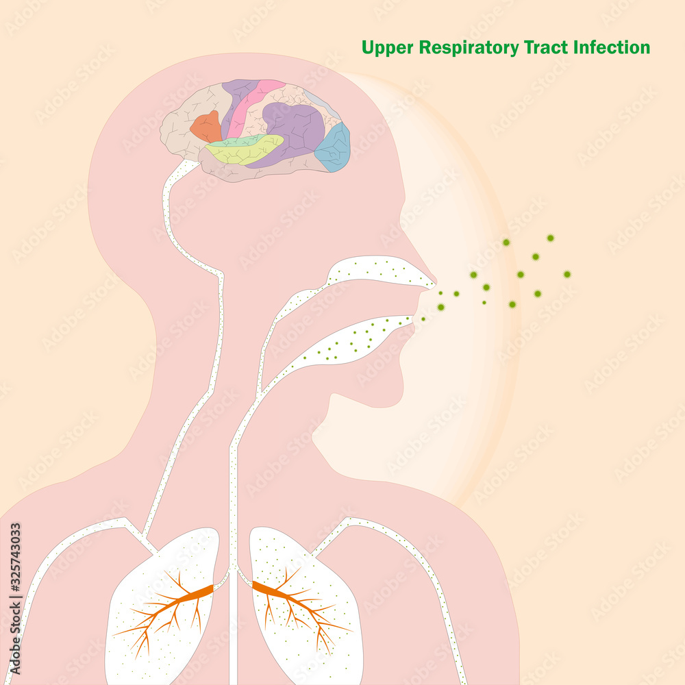 Anatomy drawing and Respiratory Tract Diseases. Upper Respiratory Tract ...