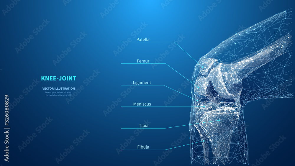 Abstract polygonal knee-joint on blue background. Infographic medicine ...