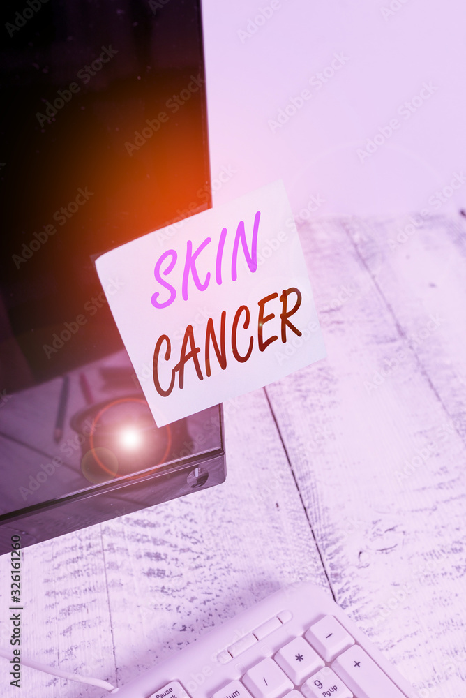Handwriting text writing Skin Cancer. Conceptual photo uncontrolled ...