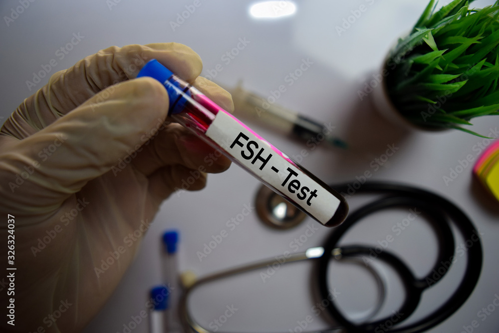 FSH - Test with blood sample. Top view isolated on color background ...