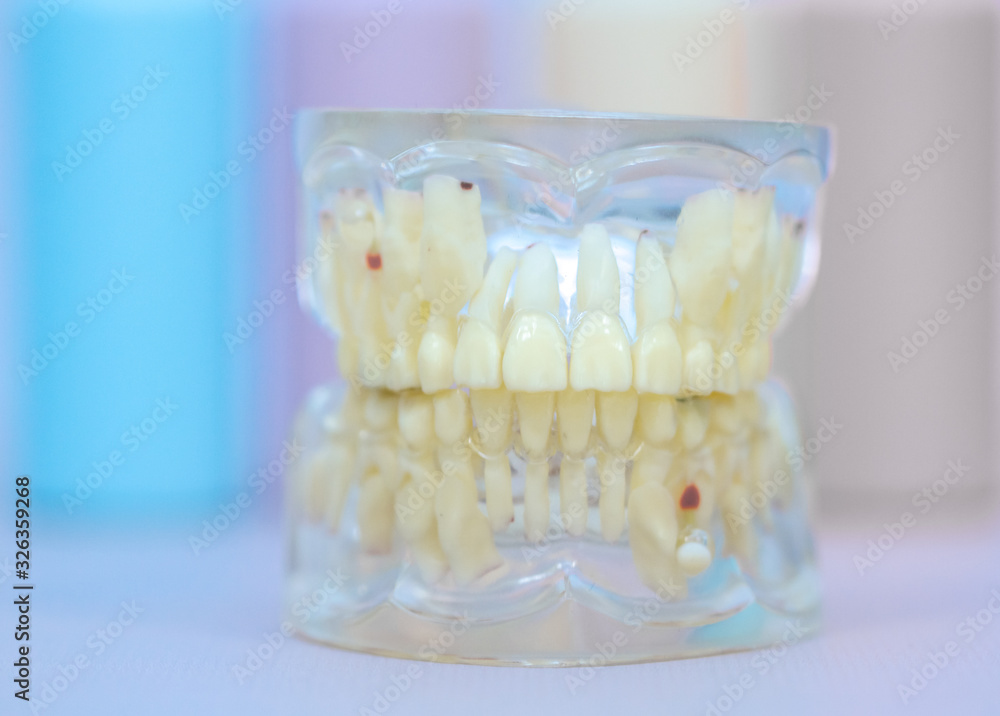Closeup on dental model on a pastel background. Milk and permanent ...
