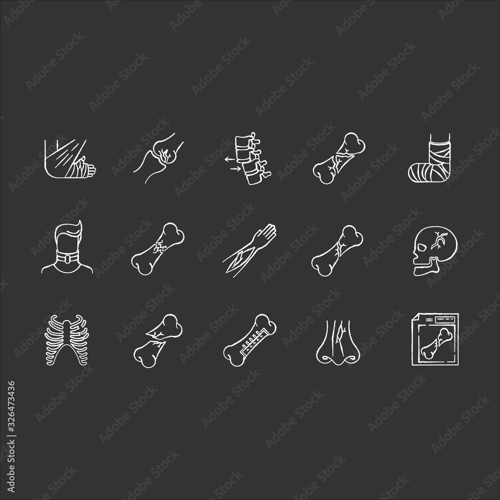 Body injuries chalk white icons set on black background. Broken arm ...