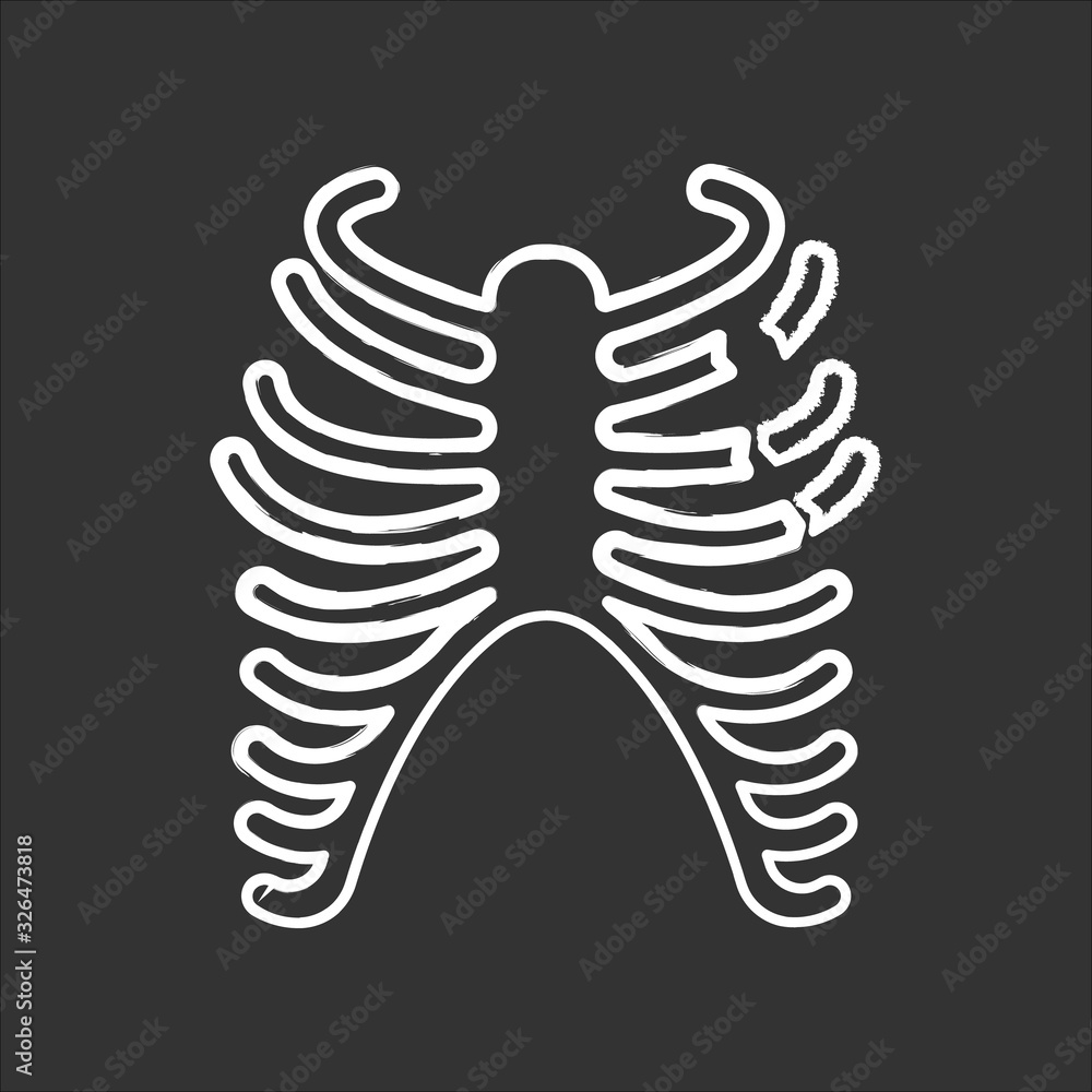 Rib fracture chalk white icon on black background. Chest injury. Broken ...