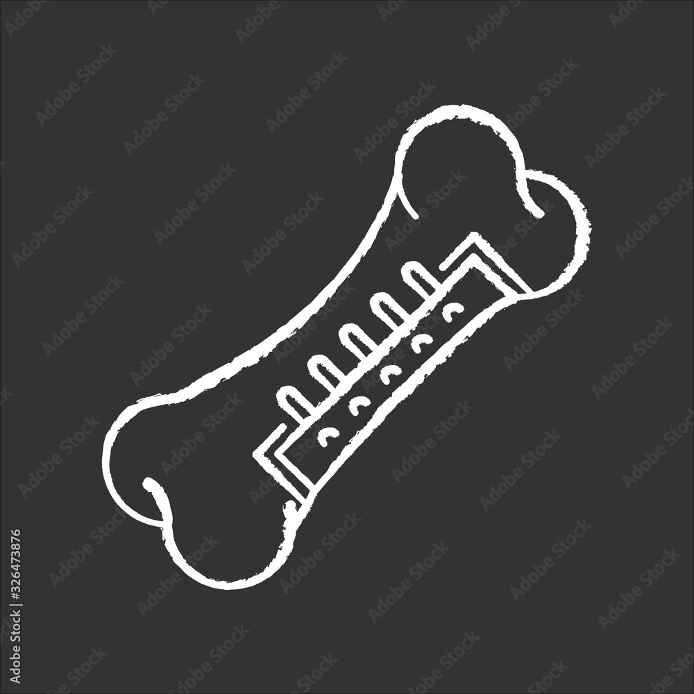 Repaired bone chalk white icon on black background. Internal fixation ...