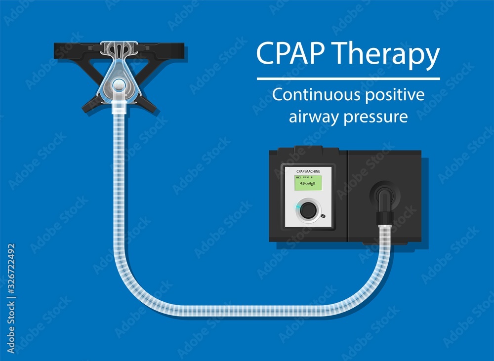 Continuous positive airway pressure (CPAP) therapy treatment ...