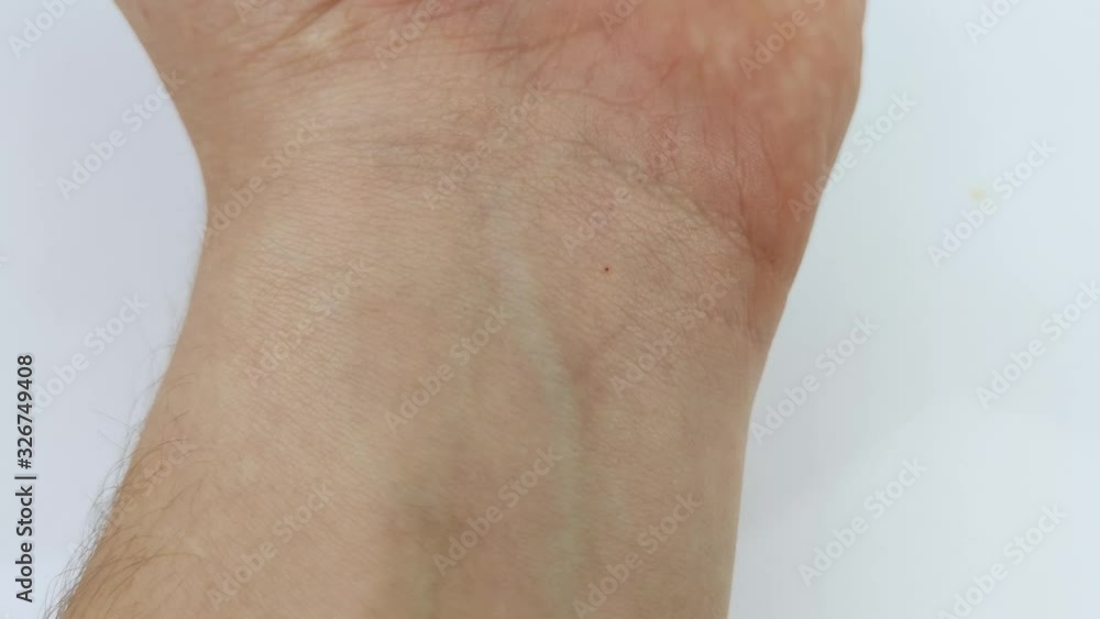 The patient compresses and unclenches the fist stimulating the flow of ...