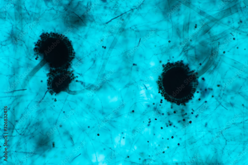 Aspergillus (mold) under microscopic view for education. Stock Photo ...