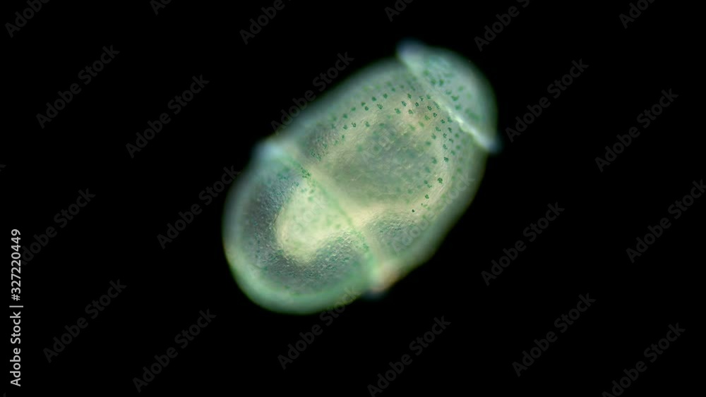 worm larva at trochophore stage with a microscope, subclass Echiura ...