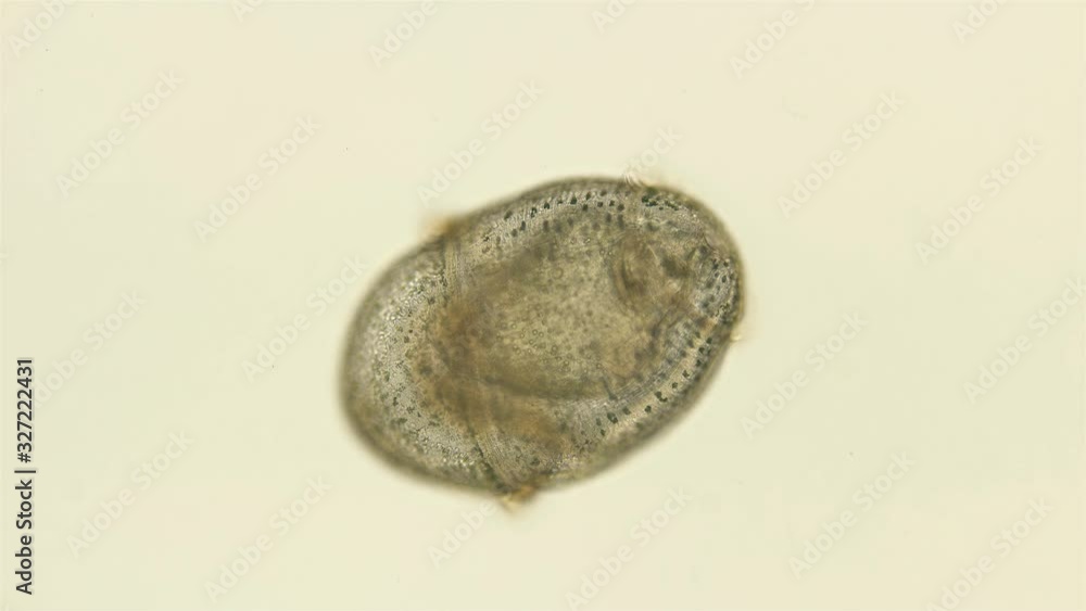 Vidéo Stock worm larva at trochophore stage with a microscope, subclass ...